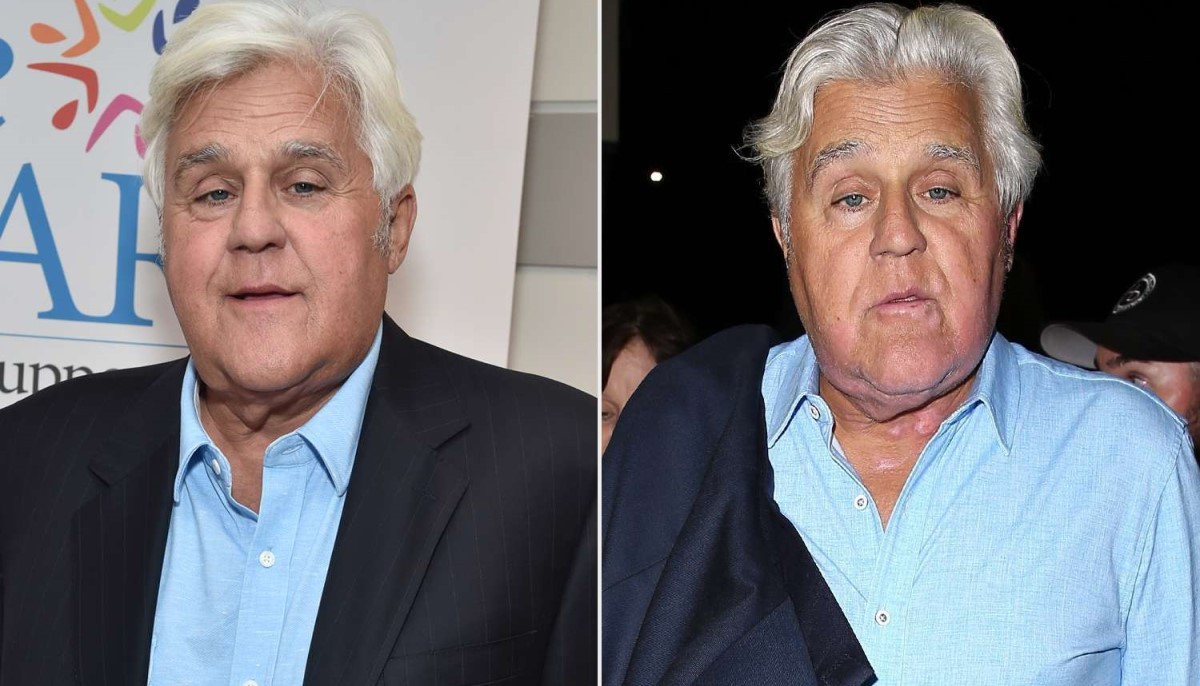 Jay Leno’s ‘brand new face’ looks better than before