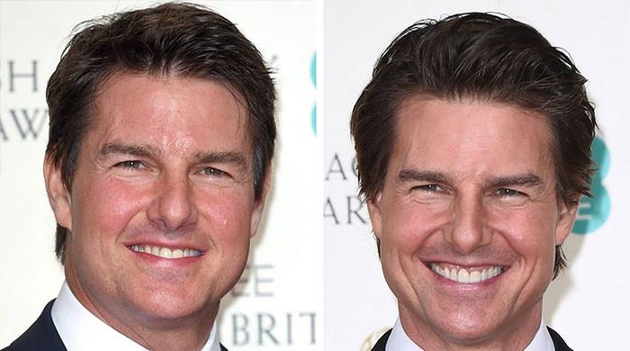 Expert claims Tom Cruise overdoing Botox - The Celeb Post