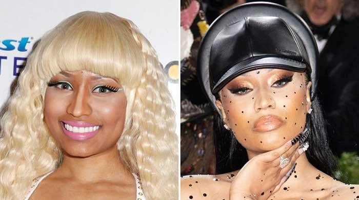 Nicki Minaj before and after skin bleaching results will shock you